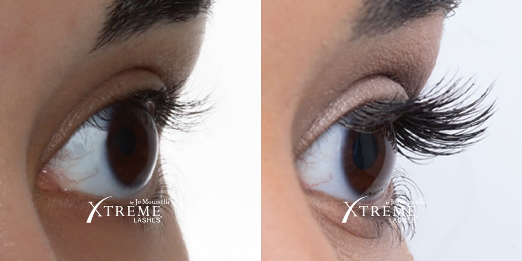 Xtreme Lash Eyelash Extensions Sudbury | SKIN MediSpa Sudbury